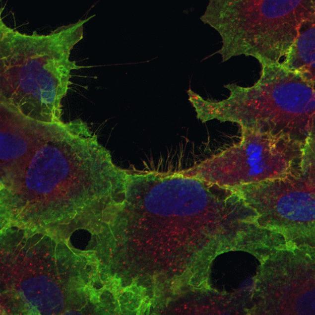 Detection of phosphorylated and total EGFR in A549 cells. | Thermo ...
