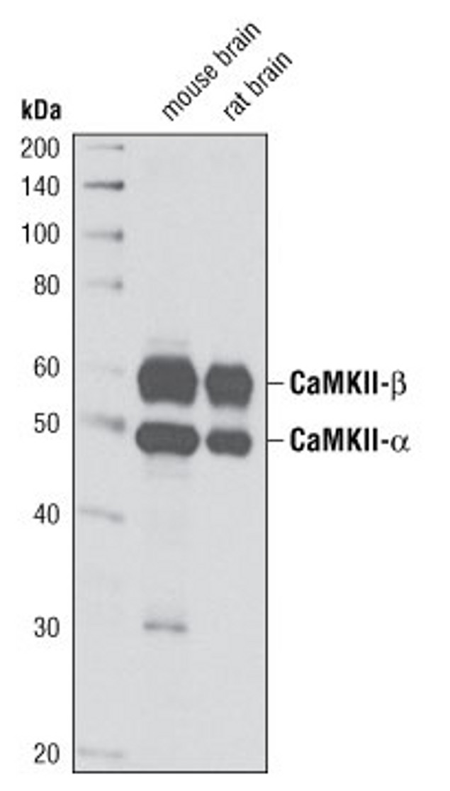 Western blot analysis of extracts from mouse and rat brain using CaMKII ...